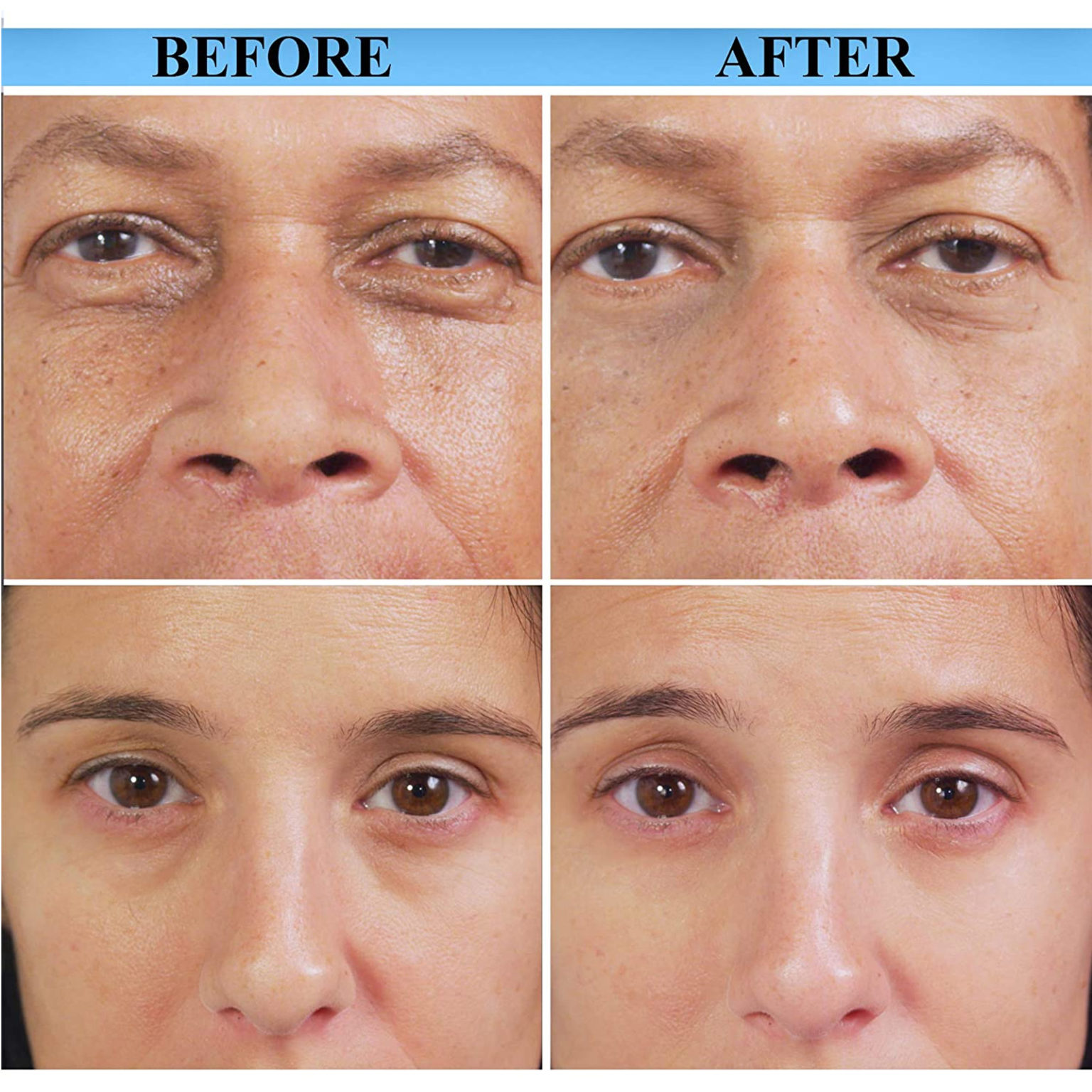 DERMA RPX | Best Of As Seen On TV
